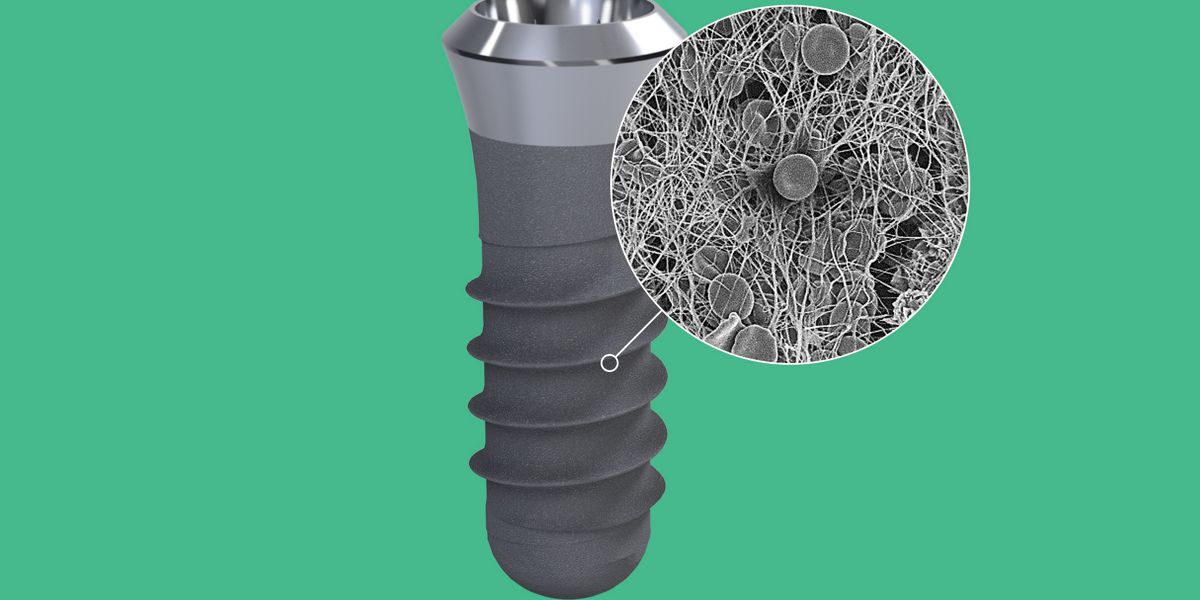 Straumann® SLActive® - Anti-inflammatory response